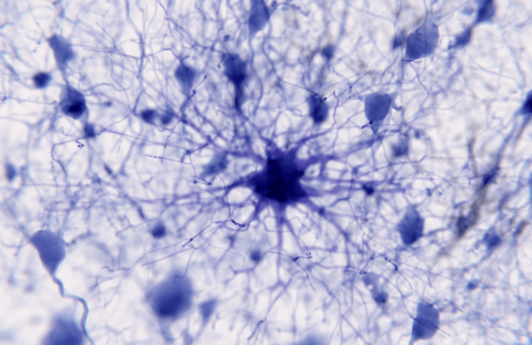 Can Sleep Deprivation Harm Your Brain? A Neuroscientist Explains ...